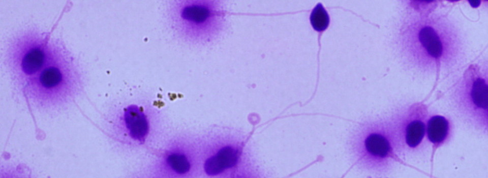 Sperm DNA Fragmentation | Valley Andrology Fertility Center